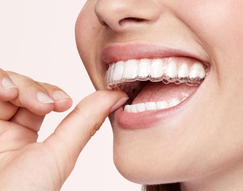 Aligners Offer | Medcare